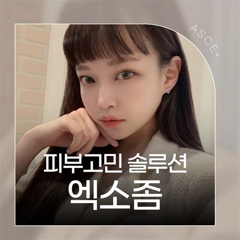 피부고민 솔루션 엑소좀 할인 가격 후기 전후 효과 정보 By 제이필의원 여신티켓 국내 1등 피부과 성형외과 플랫폼