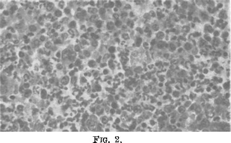 Figure 2 From Effect Of Aminopterin On Animals Receiving Myelokentric