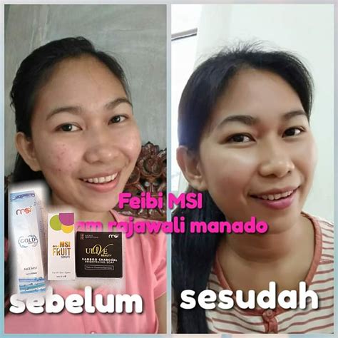 Feibi Walintukan Leader Msi