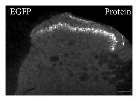 Vgluts Protein And Transcript Expressions In The Mouse Spinal Cord