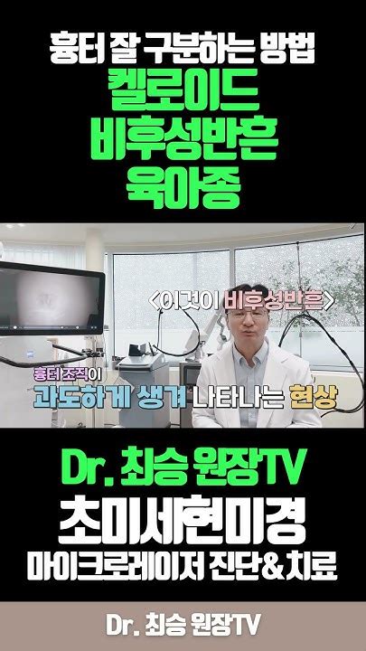 흉터 잘 구분하는 방법 켈로이드 비후성반흔 육아종 여드름흉터 닥터최승 청담노엘의원 최승원장 흉터레이저 수술흉터 튼살 화상흉터 Youtube