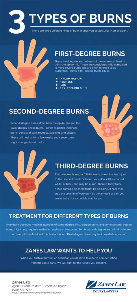3 Classification Of Burns