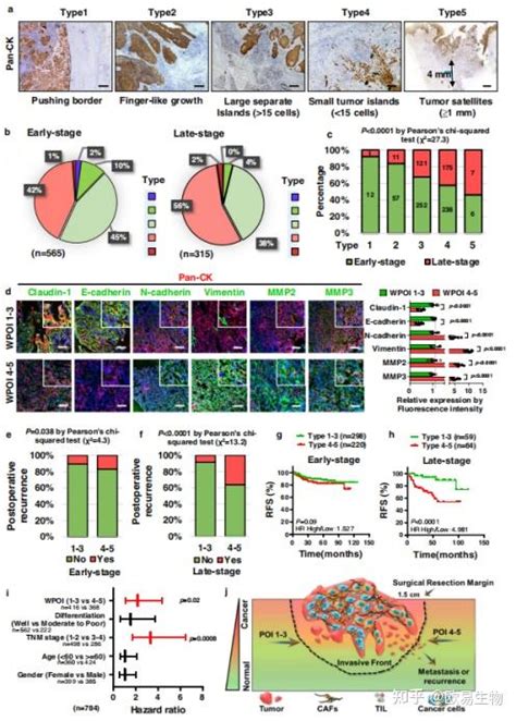 欧易生物解读——发现口腔鳞癌复发新机制 知乎