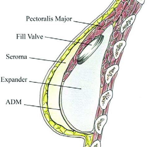 Placement Of Biological Matrix Adapted Image Showing The Placement Of