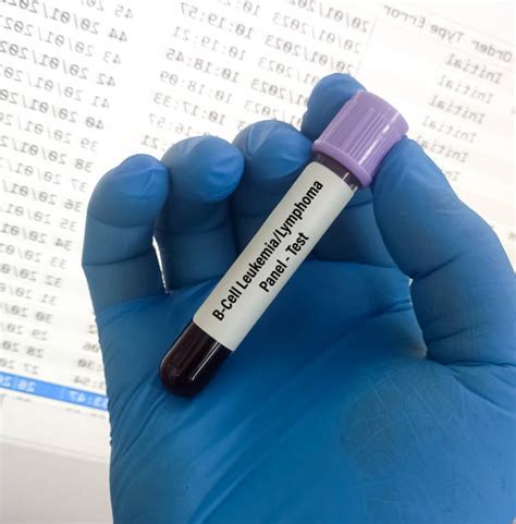 70 Flow Cytometry Foto Foto Stok Potret And Gambar Bebas Royalti Istock