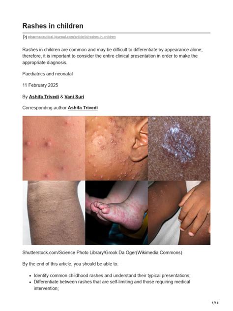 Pediatric Rash Diagnosis Guide Pdf Dermatitis Medicine