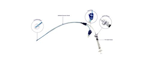 Hsg Procedure Kit With Shapeable Hsg Catheter Medgyn