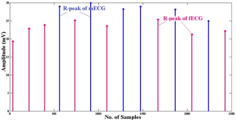 R Peak Detection Of Mecg And Fecg Signal See Online Version For