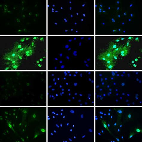Immunofluorescent Labeling Of Control A C And Experimental B D