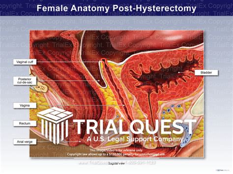 Female Anatomy Post Hysterectomy Close Up View