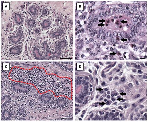 Cellularity Of Tissues From Saline And Staph Aureus Quarter Lobules A