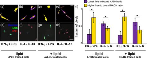 Label Free Identification Of Macrophage Phenotype By Fluorescence Lifetime Imaging Microscopy