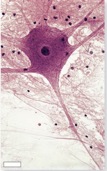 Axon Labeling Real Image Diagram Quizlet