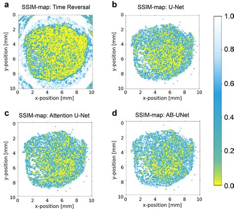 Comparison Of Structural Similarity Ssim Map Based On Different Cnn