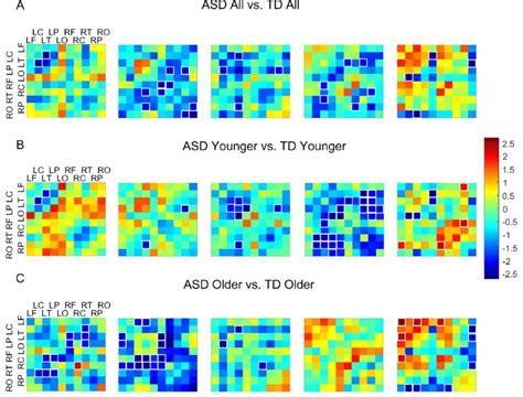 Schematic Illustration Of Significant Differences Of Connectivity Download Scientific Diagram