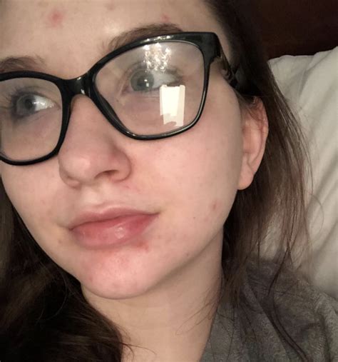 Products That Ll Basically Stop Pimples In Their Tracks