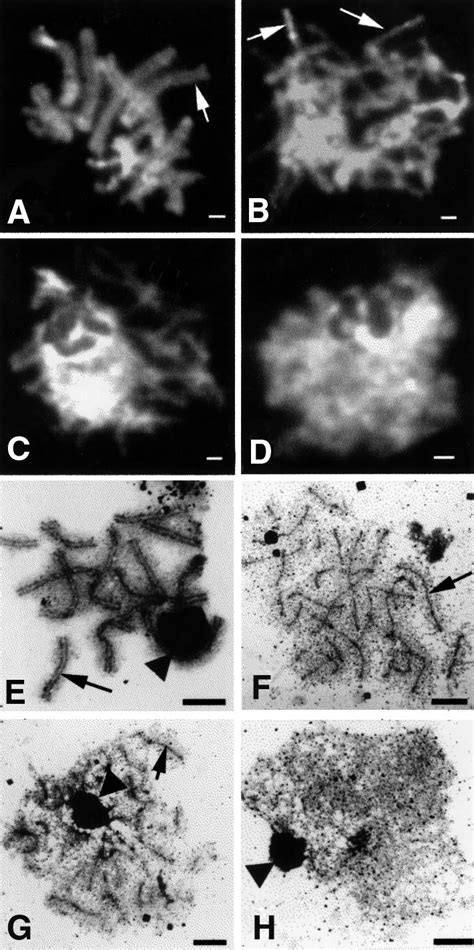 Multiple Roles Of Spo11 In Meiotic Chromosome Behavior Pmc