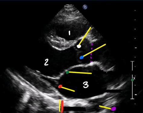 1130 Module 3a Flashcards Quizlet