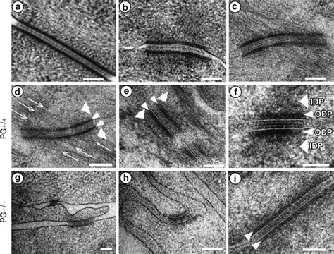 Desmosomes Skin