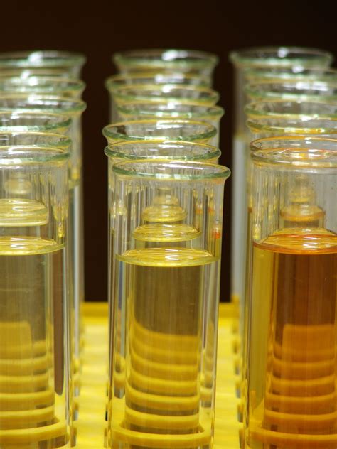 Royal Bahrain Hospital Urodynamic Testing
