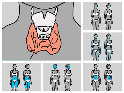 12 Symptoms Of Thyroid Disorder