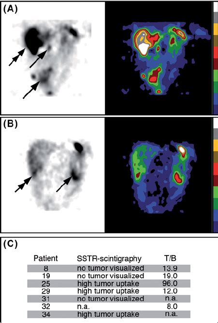 Gist In Primary Culture Tumor Cells Were Positive For The Gist Markers Download Scientific
