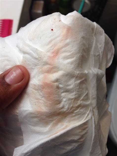 Implantation Bleeding Glow Community