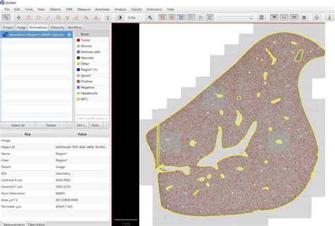 Stardist Issues With Qupath 044 Tiles Left Empty Image Analysis Imagesc Forum