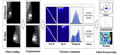 The Radiomics Workflow Of Acquisition And Pre Processing 46