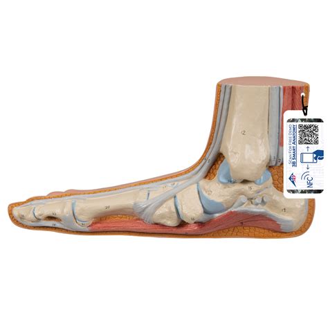 Hollow Foot Pes Cavus Model 3b Smart Anatomy Sem Trainers