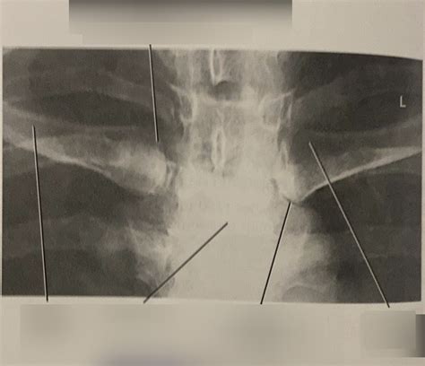 Sc Joints 1 Diagram Quizlet