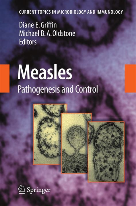 Measles Pathogenesis And Control 1st Edition Premiumjs Store