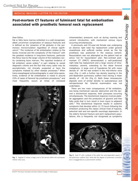 Post‐mortem Ct Features Of Fulminant Fatal Fat Journal Of Medical