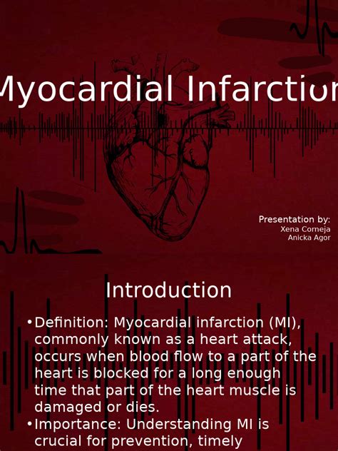 Myocardial Infarction Presentation 1 Pdf