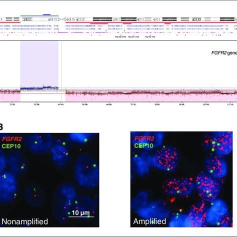 Fgfr2 Gene Amplification In Chinese And Caucasian Gastric Cancer Download Scientific Diagram