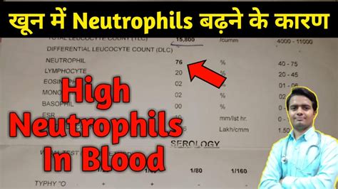 Neutrophil Blood Test What High And Low Levels Mean 53 Off