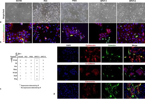 Identification Of OPCT As A Suitable Model For The Study Of Download Scientific Diagram