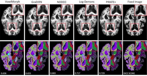 a plug and play image registration network
