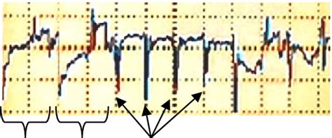 The Flex Sensor Output Viewed On An Oscilloscope Download Scientific Diagram