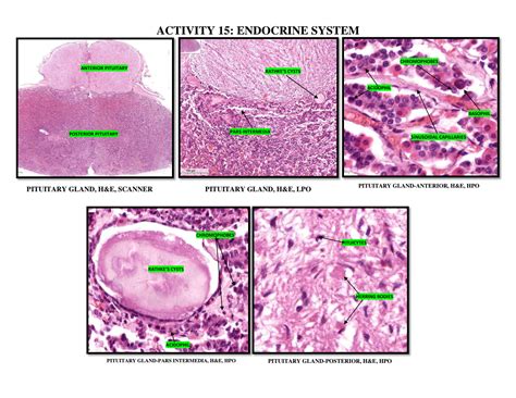 Solution Histopathology Endocrine System Studypool