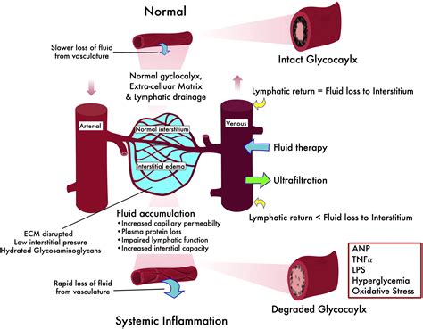 Pediatric Fluid Overload At Yvonne Hosford Blog
