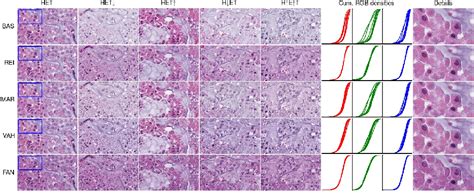 Context Based Normalization Of Histological Stains Using Deep Convolutional Features