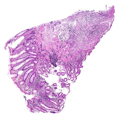 体内空间转录组学 深圳市安瑞生物科技有限公司