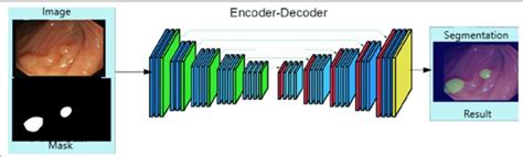 Figure 4 From Automatic Detection Of Colorectal Polyps Using Transfer Learning Semantic Scholar