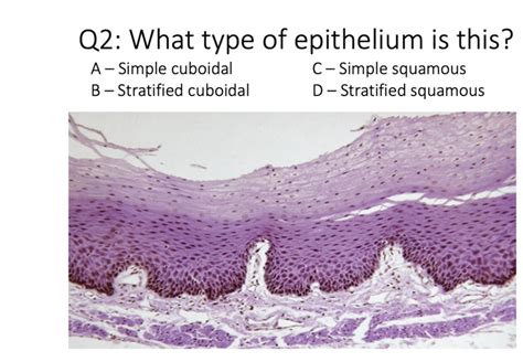 What Type Of Epithelium Is This A Simple Cuboidal C Simple Squamous B Stratified Cuboidal D