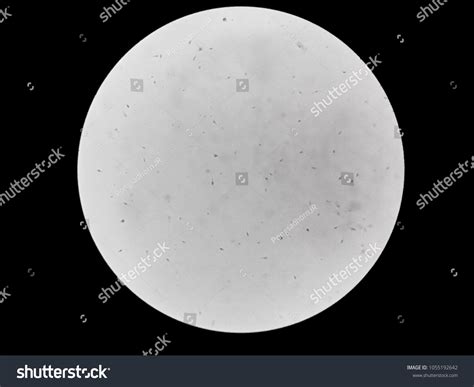 Human Sperm Cell Under Microscope Foto Stock 1055192642 Shutterstock