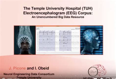 The Temple University Hospital Eeg Corpus Sapien Labs Shaping The