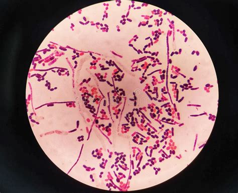 Yeast Cells And Hyphae In Gram Stain Fine With Microscope Stock Photo