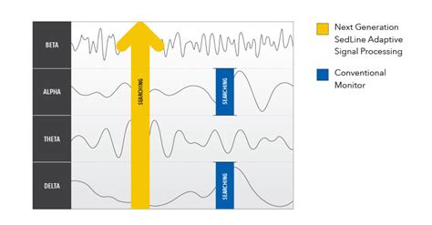 Masimo Next Generation Sedline® Brain Function Monitor