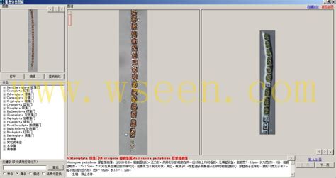 万深检测考种仪根系分析仪藻类鉴定计数仪大米外观品质检测仪菌落计数仪抑菌圈测量仪叶面积仪冠层仪线序检测仪